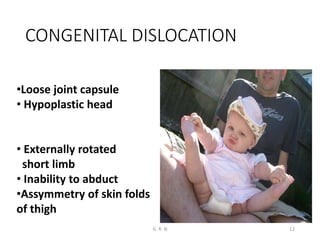 Radiological anatomy of the lower limb r | PDF