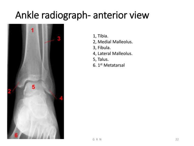 Radiological Anatomy Of The Lower Limb R Ppt