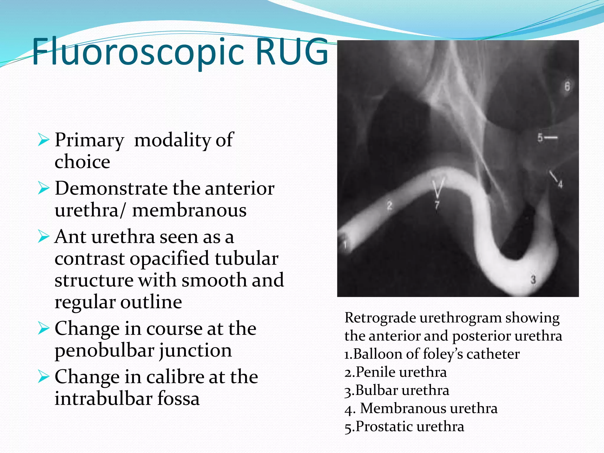 Radiological anatomy of the male urethra and techniques of imaging | PPTX