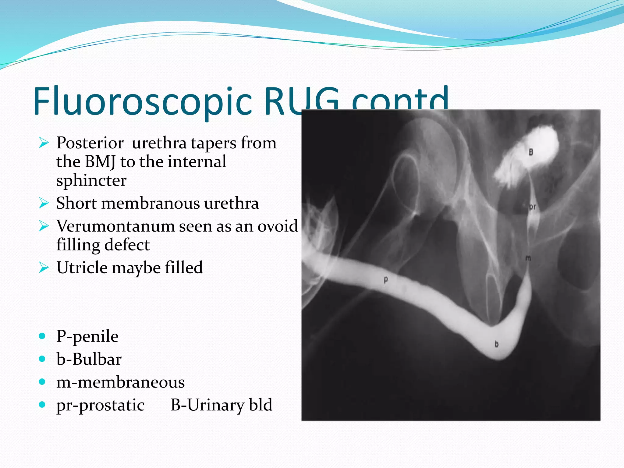 Radiological anatomy of the male urethra and techniques of imaging | PPTX