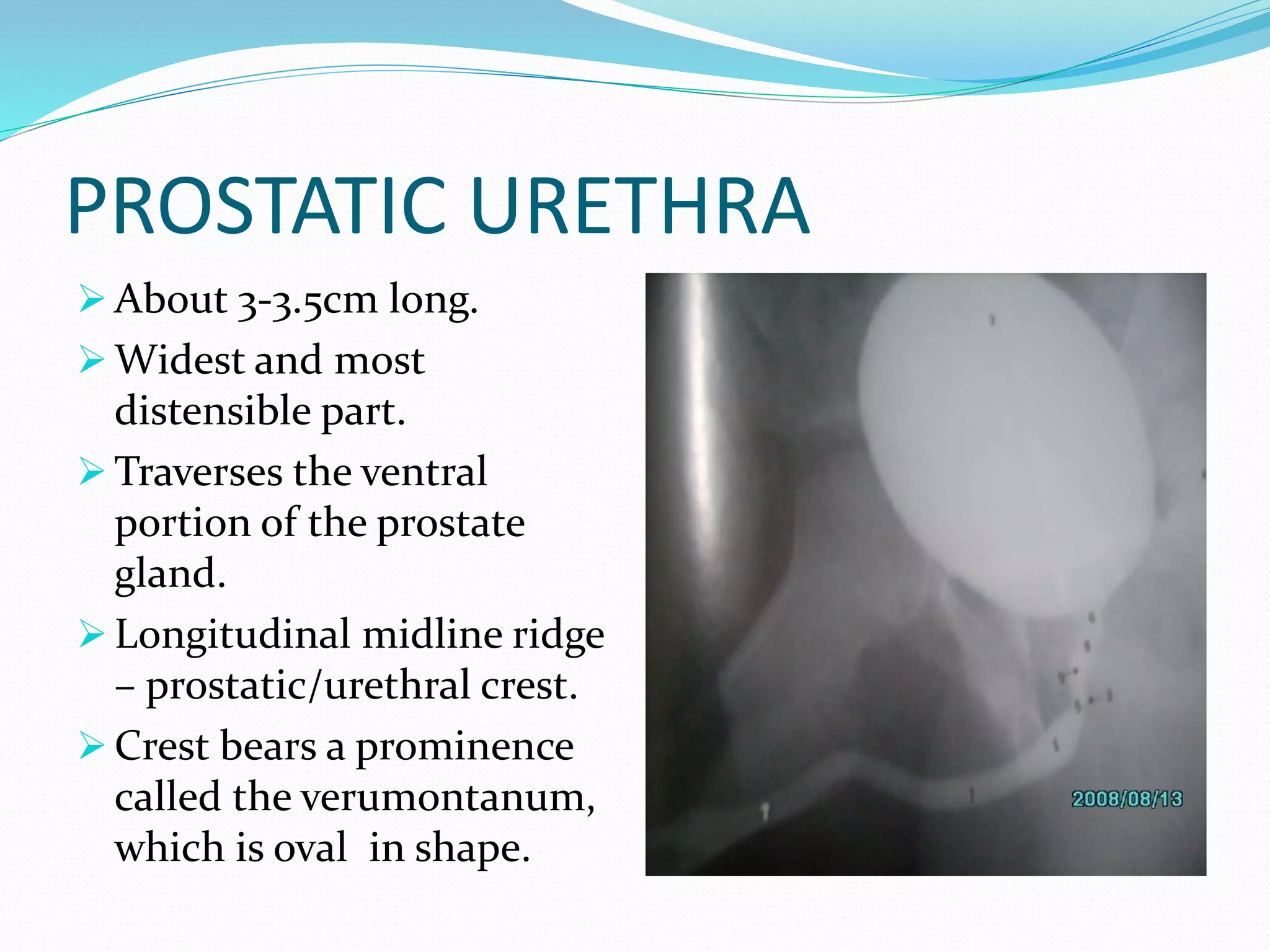 Radiological anatomy of the male urethra and techniques of imaging | PPTX