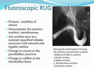 Fluoroscopy And Urethral Anatomy