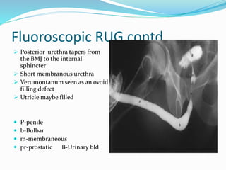 Fluoroscopy And Urethral Anatomy