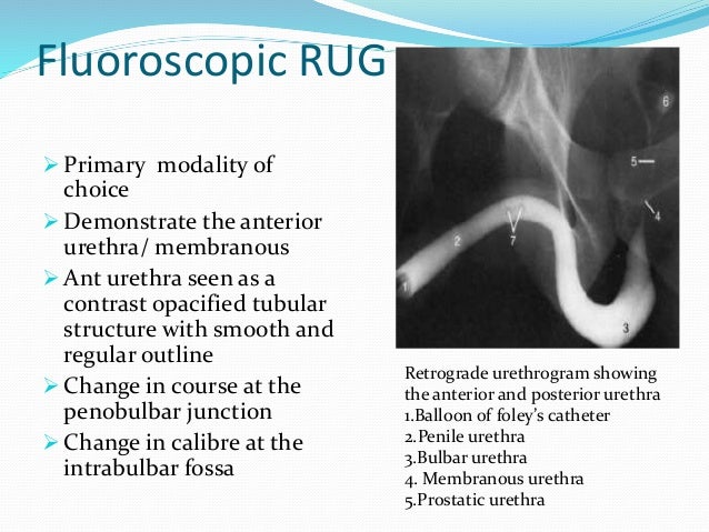 Radiological anatomy of the male urethra and techniques of imaging