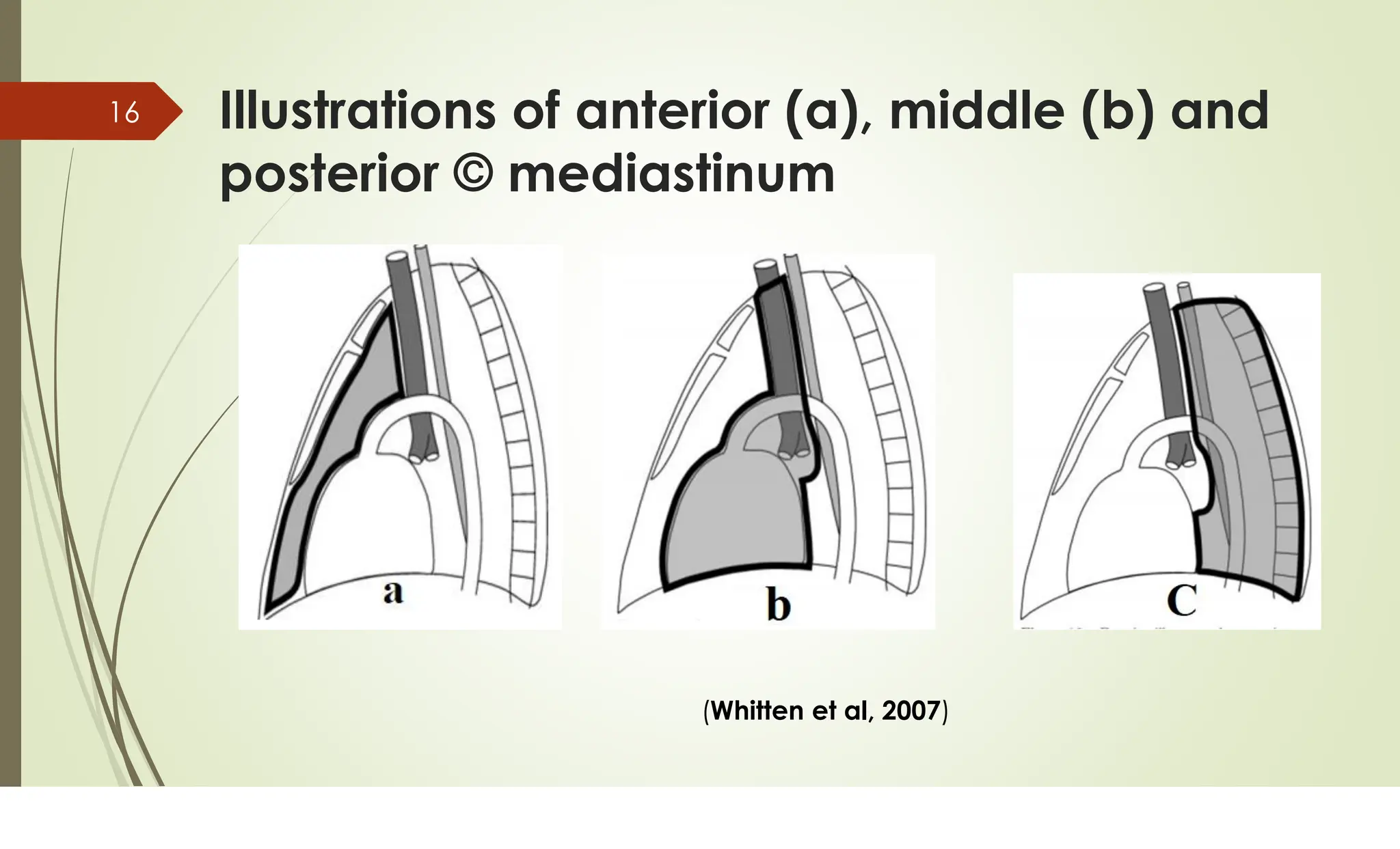 RADIOLOGICAL ANATOMY OF THE MEDIASTINUM.PDF