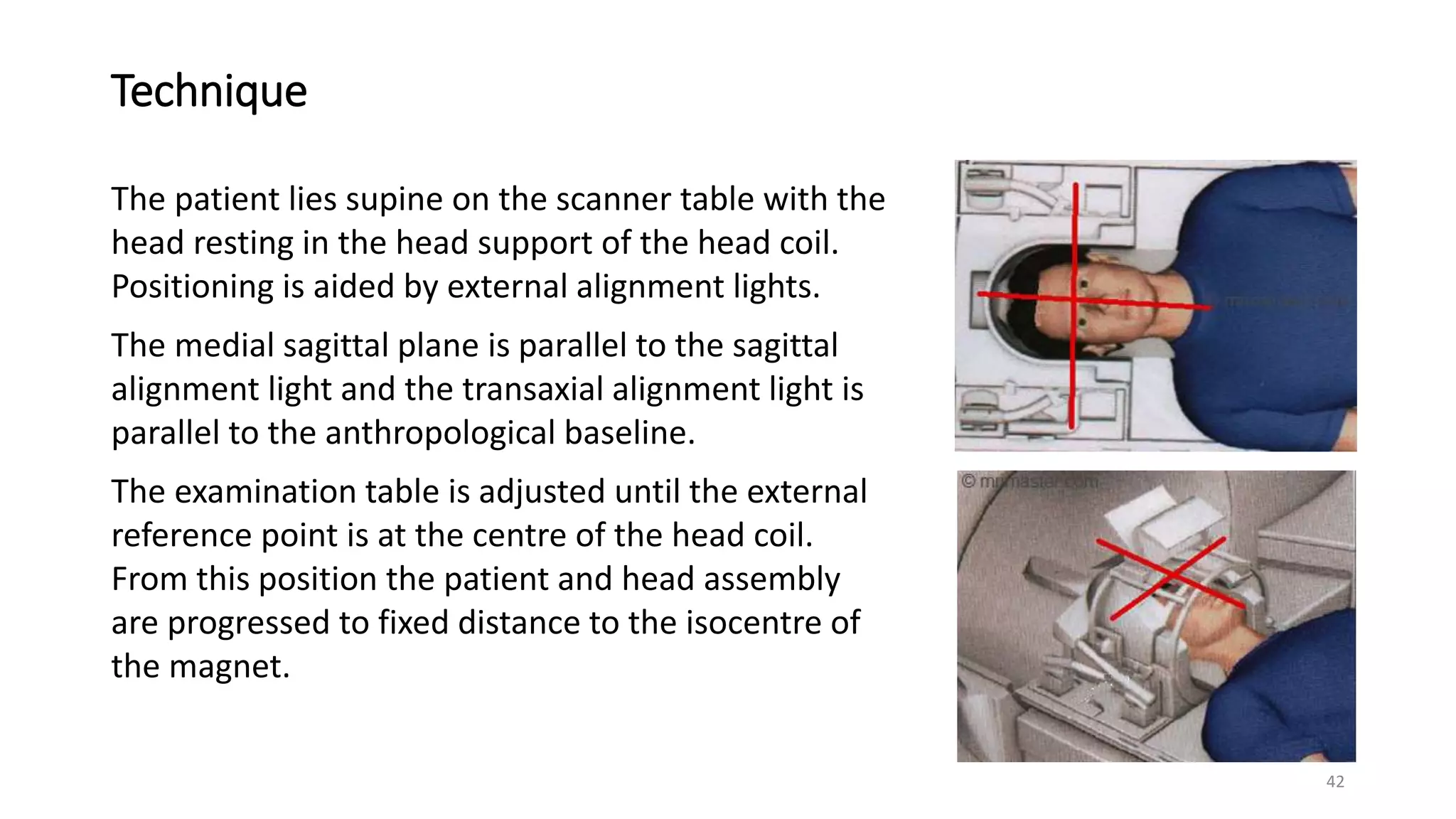 RADIOLOGICAL ANATOMY OF THE PITUITARY GLAND AND TECHNIQUES.pptx