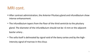 RADIOLOGICAL ANATOMY OF THE PITUITARY GLAND AND TECHNIQUES.pptx