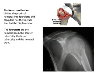 Radiological anatomy of the upper limb r | PDF