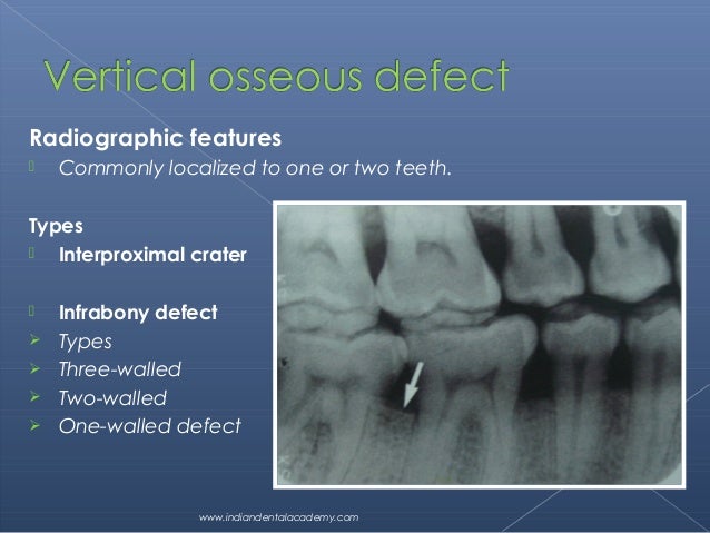 Radiological aspects of periodontal disease/cosmetic dentistry courses
