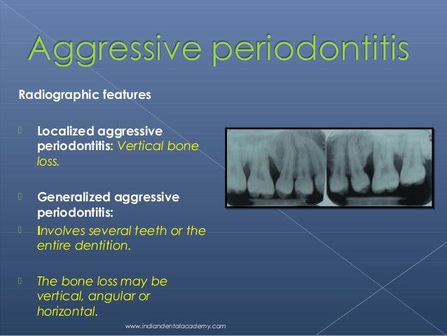 Radiological aspects of periodontal disease/cosmetic dentistry courses