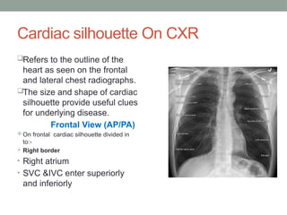 Radiological Cardiac Anatomyjhdcdsdsdkd.pptx