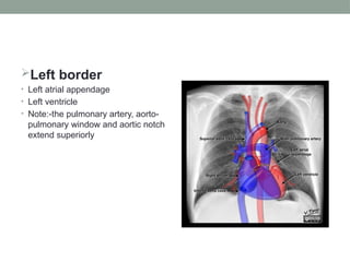 Radiological Cardiac Anatomyjhdcdsdsdkd.pptx