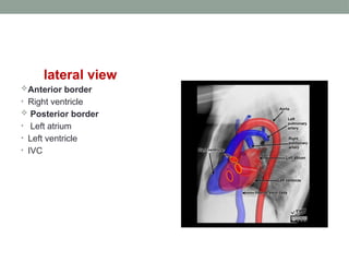 Radiological Cardiac Anatomyjhdcdsdsdkd.pptx