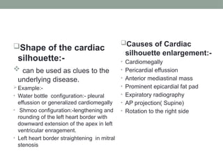 Radiological Cardiac Anatomyjhdcdsdsdkd.pptx