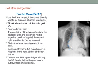 Radiological Cardiac Anatomyjhdcdsdsdkd.pptx