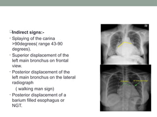 Radiological Cardiac Anatomyjhdcdsdsdkd.pptx