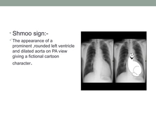 Radiological Cardiac Anatomyjhdcdsdsdkd.pptx