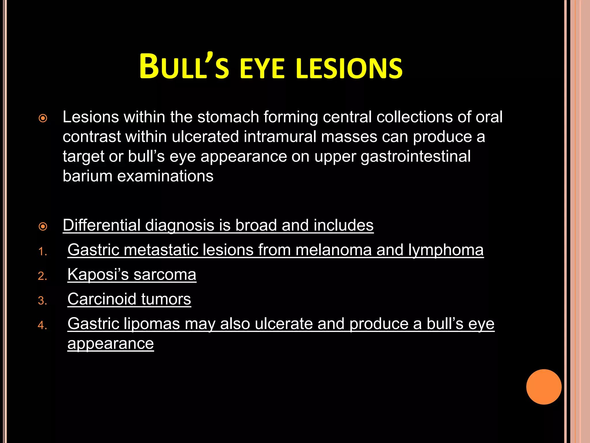 Radiology ----Classical Signs in GIT Dr. Muhammad Bin Zulfiqar | PPTX
