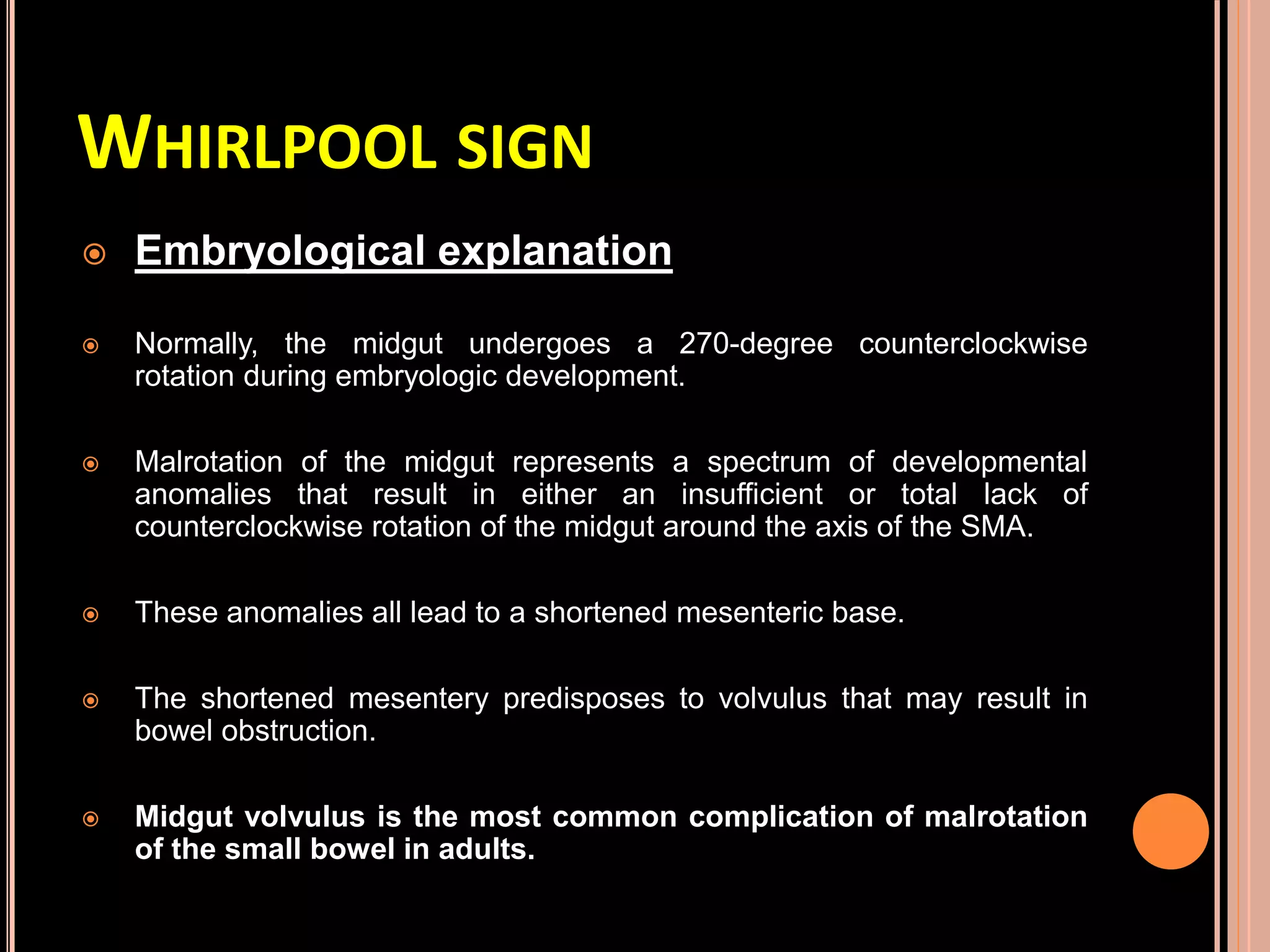 Radiology ----Classical Signs in GIT Dr. Muhammad Bin Zulfiqar | PPTX