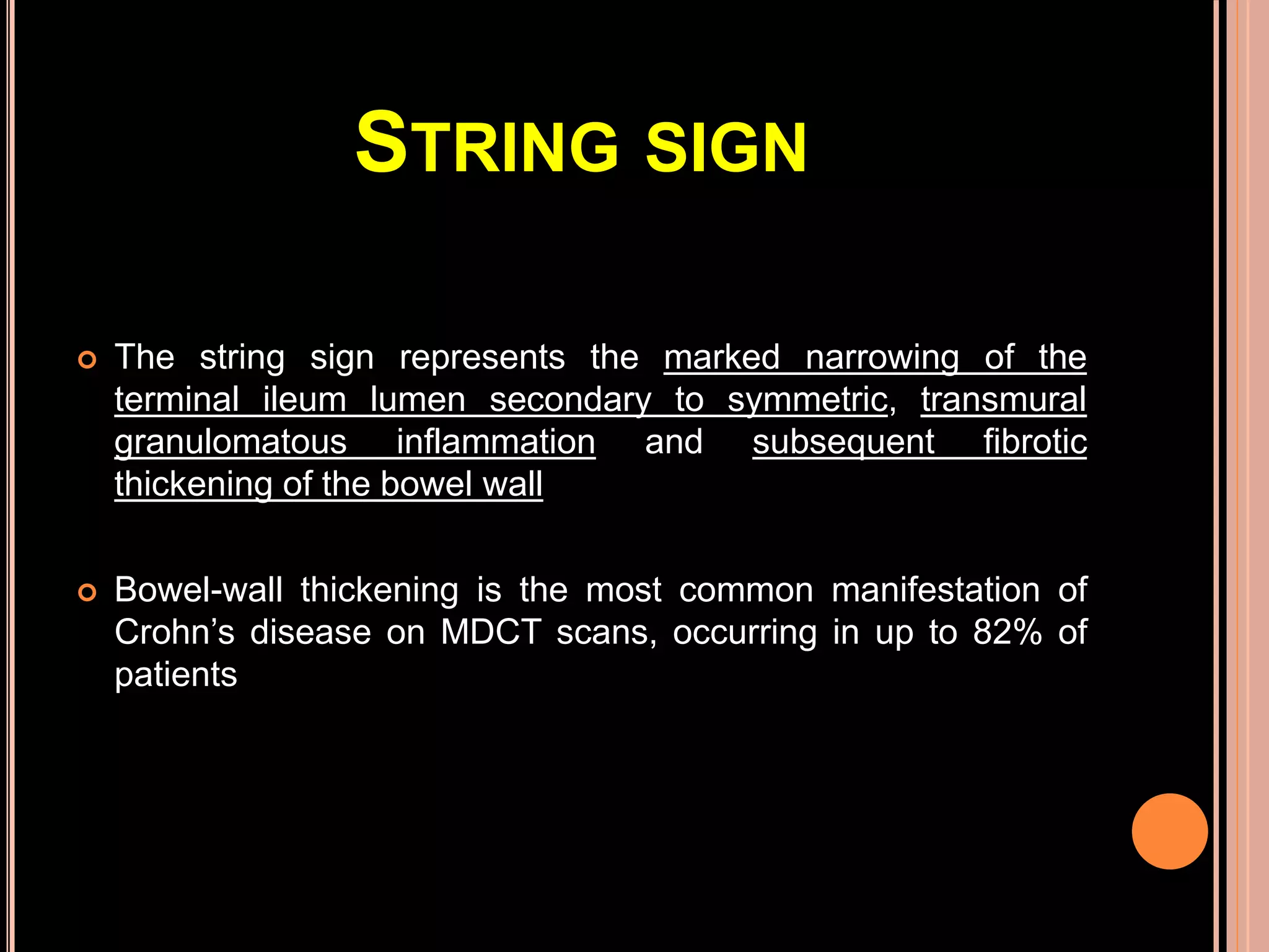 Radiology ----Classical Signs in GIT Dr. Muhammad Bin Zulfiqar | PPTX
