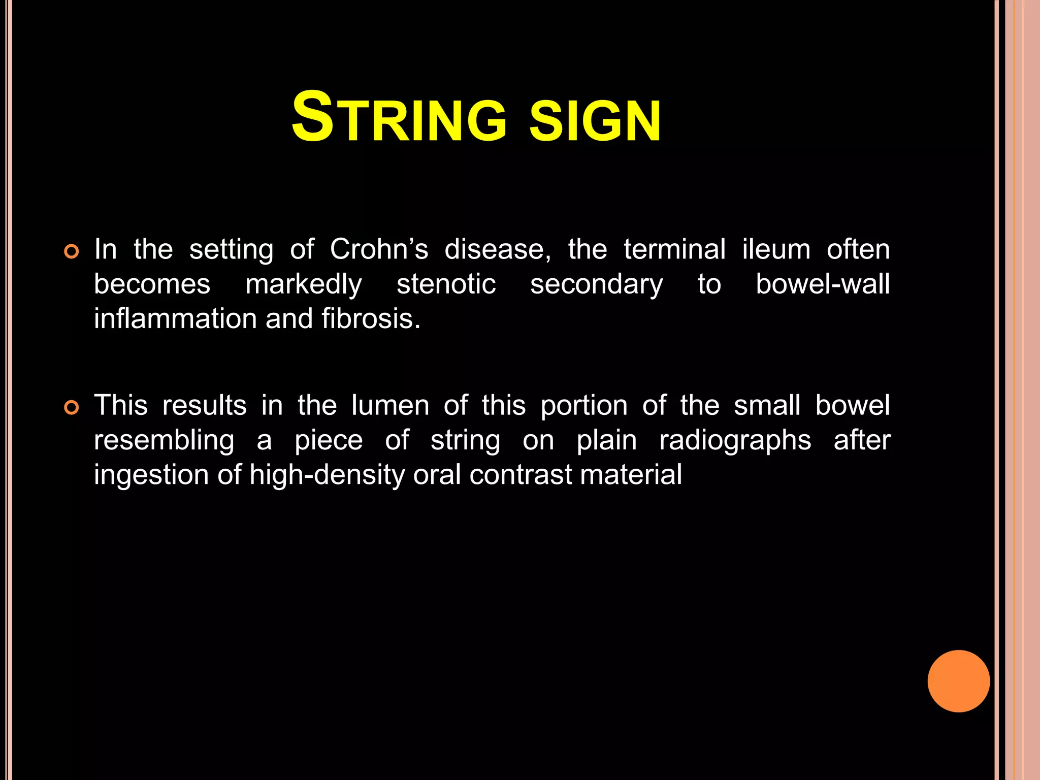 Radiology ----Classical Signs in GIT Dr. Muhammad Bin Zulfiqar | PPTX