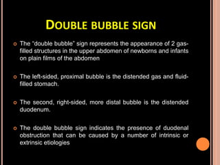 Radiology ----Classical Signs in GIT Dr. Muhammad Bin Zulfiqar | PPTX