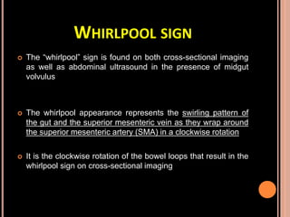 Radiology ----Classical Signs in GIT Dr. Muhammad Bin Zulfiqar | PPTX
