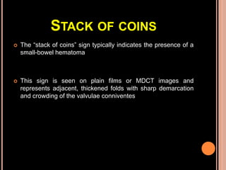 Radiology ----Classical Signs in GIT Dr. Muhammad Bin Zulfiqar | PPTX