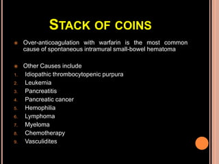 Radiology ----Classical Signs in GIT Dr. Muhammad Bin Zulfiqar | PPTX