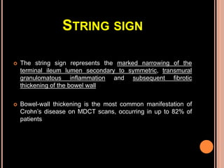 Radiology ----Classical Signs in GIT Dr. Muhammad Bin Zulfiqar | PPTX