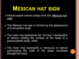 Radiology ----Classical Signs in GIT Dr. Muhammad Bin Zulfiqar | PPTX