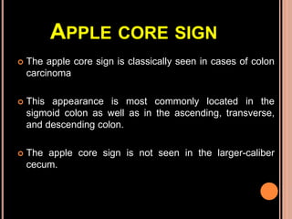 Radiology ----Classical Signs in GIT Dr. Muhammad Bin Zulfiqar | PPTX