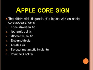 Radiology ----Classical Signs in GIT Dr. Muhammad Bin Zulfiqar | PPTX