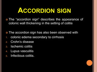 Accordion Sign