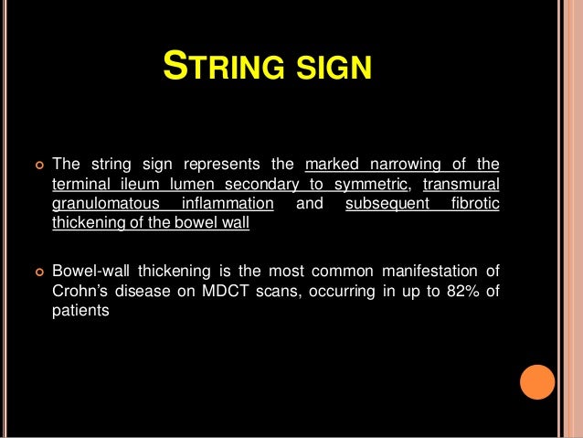 Radiology ----Classical Signs in GIT Dr. Muhammad Bin Zulfiqar