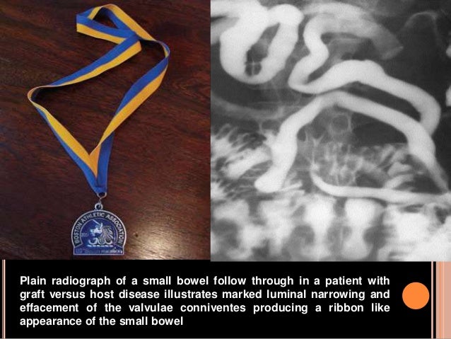 Radiology ----Classical Signs in GIT Dr. Muhammad Bin Zulfiqar