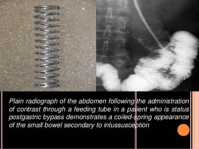 Radiology ----Classical Signs in GIT Dr. Muhammad Bin Zulfiqar
