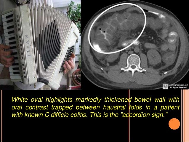 Radiology ----Classical Signs in GIT Dr. Muhammad Bin Zulfiqar