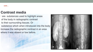 Radiological contrast media TUtoriai Rad.1.2.pptx