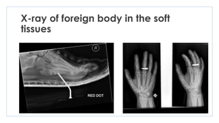 Radiological diagnosis of foreign body | PPTX