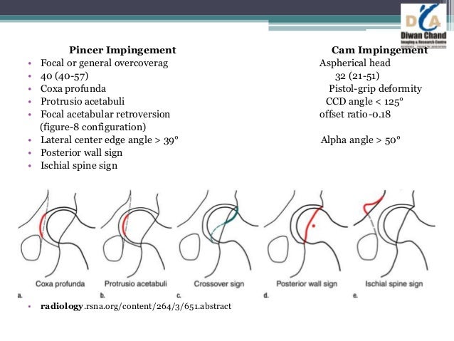 Radiological evaluation of hip pn
