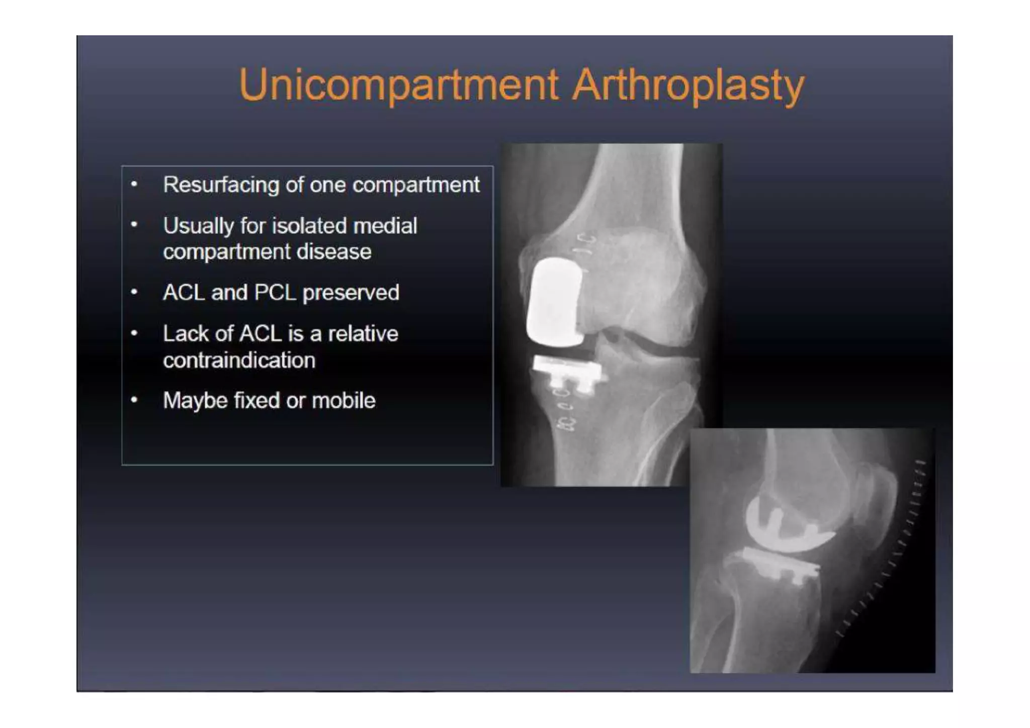 Radiological evaluation of TKR by Dr. D. P. Swami | PPTX
