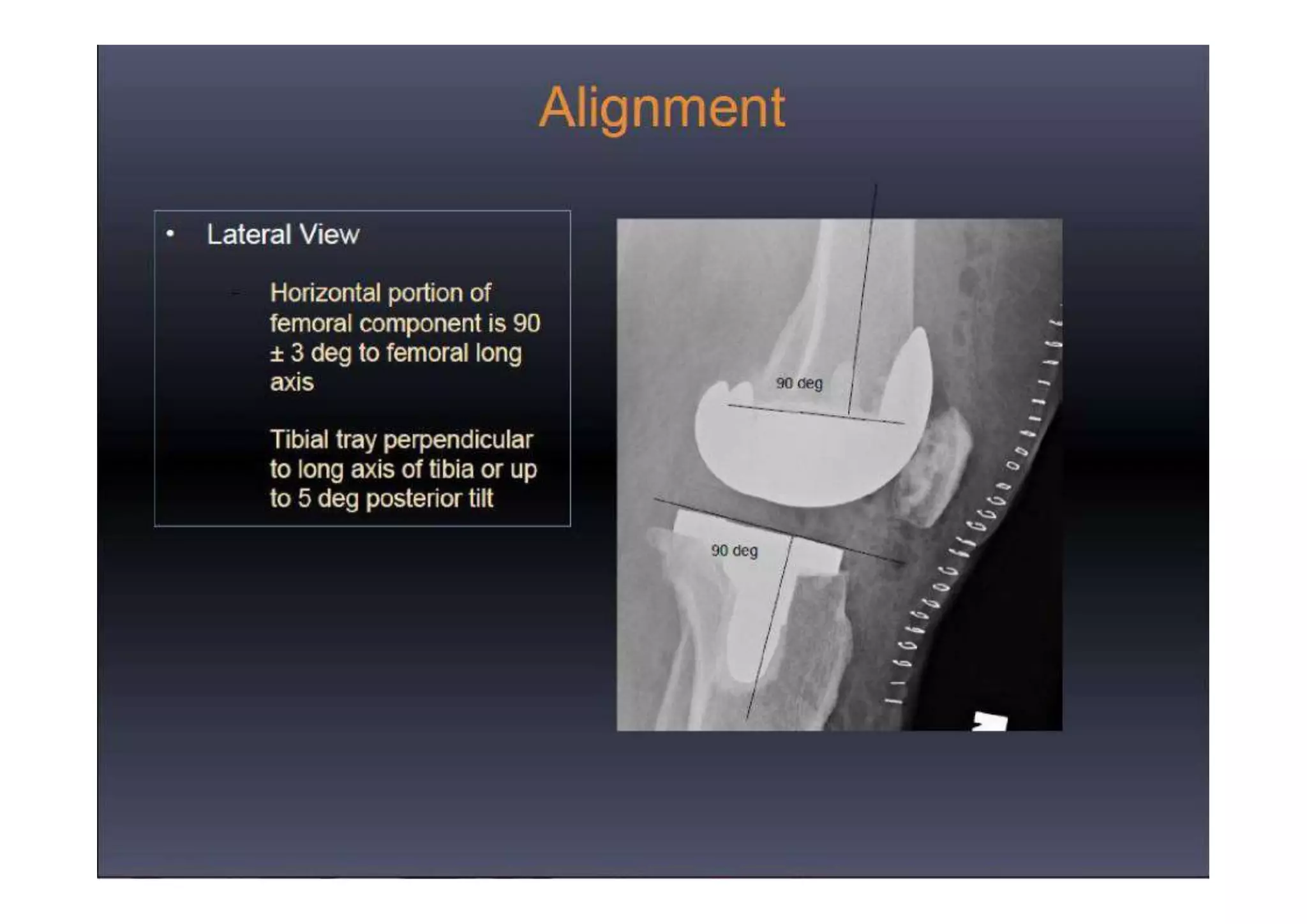 Radiological evaluation of TKR by Dr. D. P. Swami | PPTX