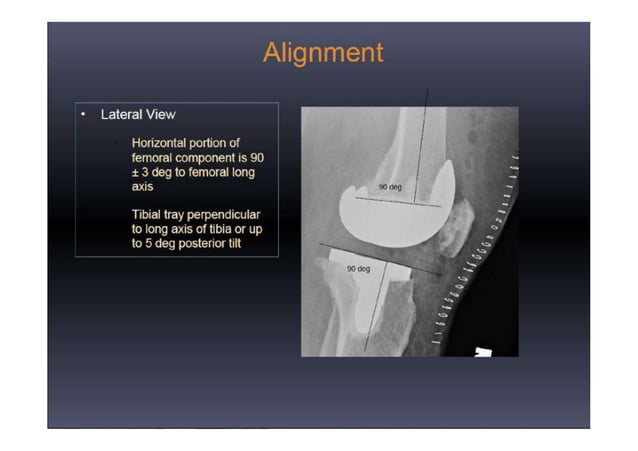 Radiological evaluation of TKR by Dr. D. P. Swami | PPTX