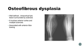 Radiological features in bone tumors | PPTX