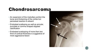 Radiological features in bone tumors | PPTX