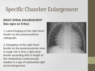 Radiological Features of Acquired Heart Disease (2).pptx