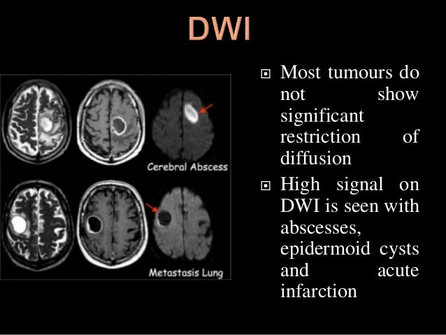 Radiological features of intracranial tumors 1