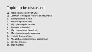 Radiological features of pneumonia | PPTX