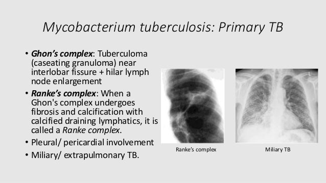 Radiological features of pneumonia